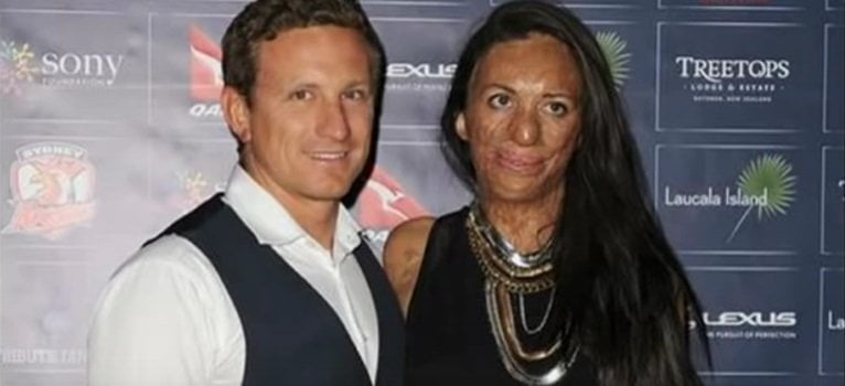 Igazi szerelem: Michael Hoskin megkérte barátnője kezét, aki egy ...